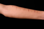 Cutting One s Skin Is A Cry For Attention And Help Minnesota Cutting One s Skin Is A Cry For Attention And Help Minnesota
