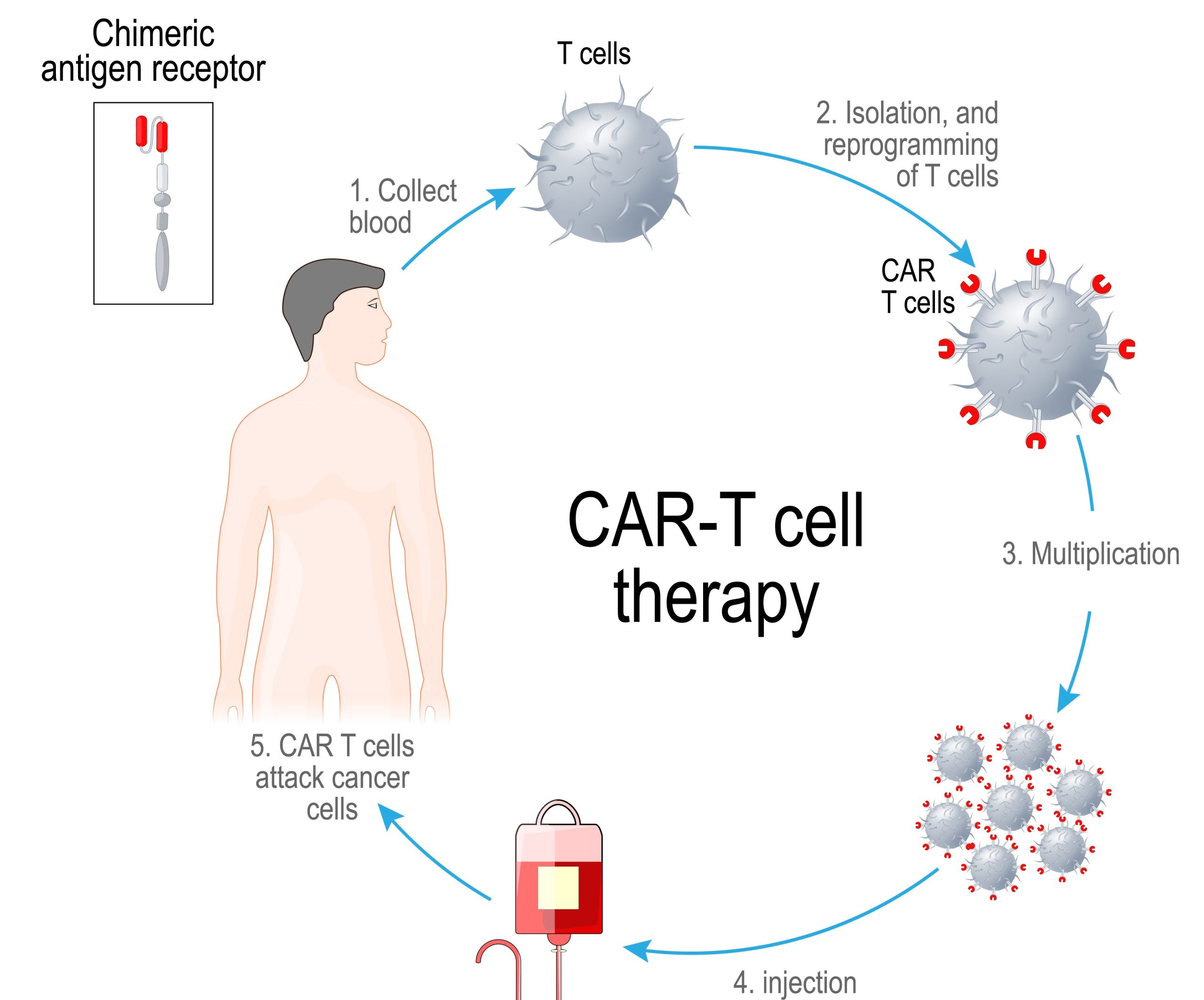 CAR-T therapy: a new weapon in the war against cancer | Minnesota ...